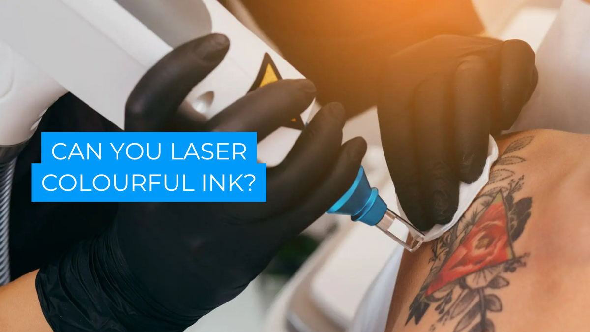 Can you remove colourful body ink with Laser Tattoo Removal? – Cosmedic ...